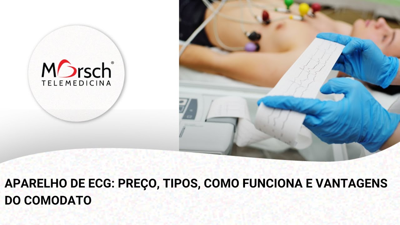 APARELHO DE ECG: PREÇO, TIPOS, COMO FUNCIONA E VANTAGENS DO COMODATO ...