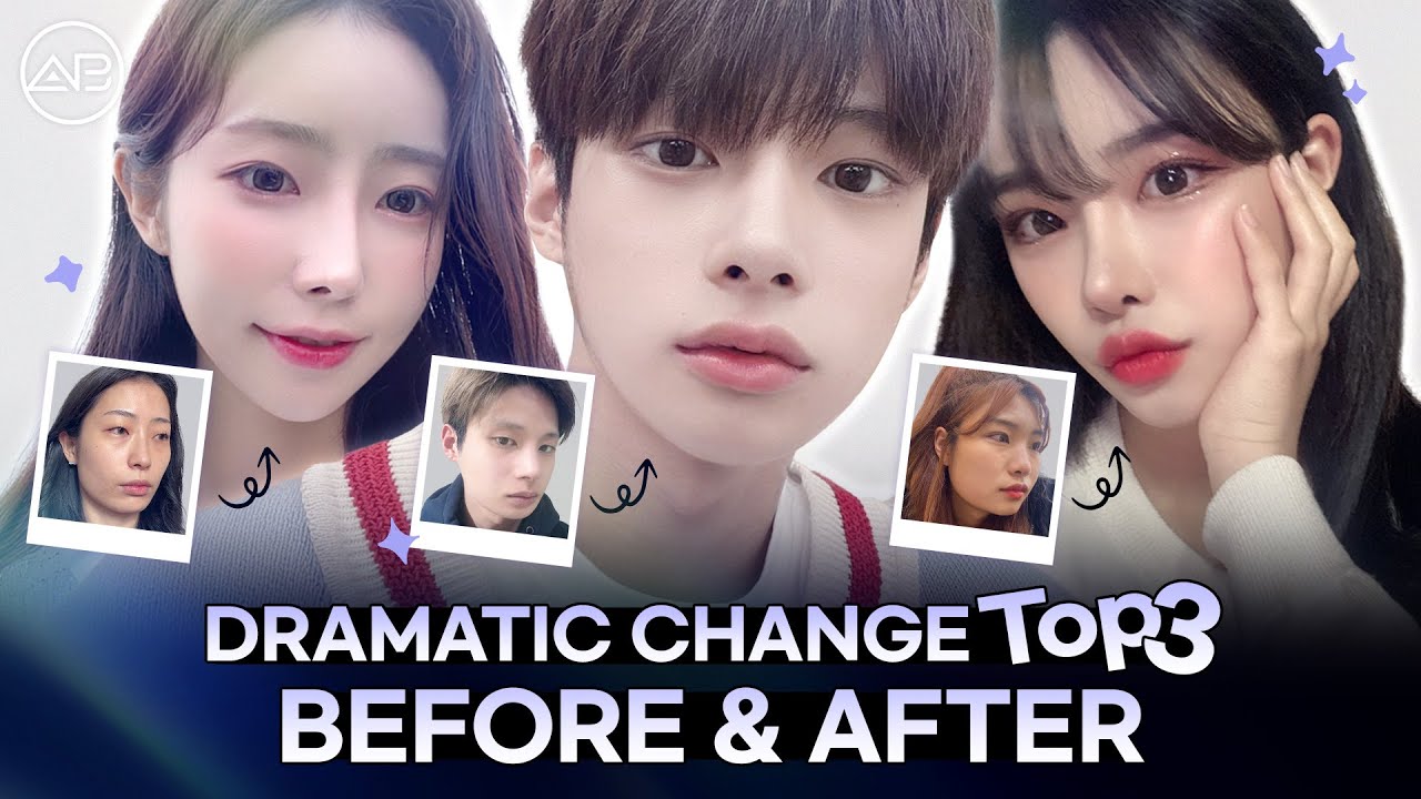 Top 3 Jaw-Dropping Plastic Surgery Glow-Ups in Korea 🇰🇷 | AB Plastic ...
