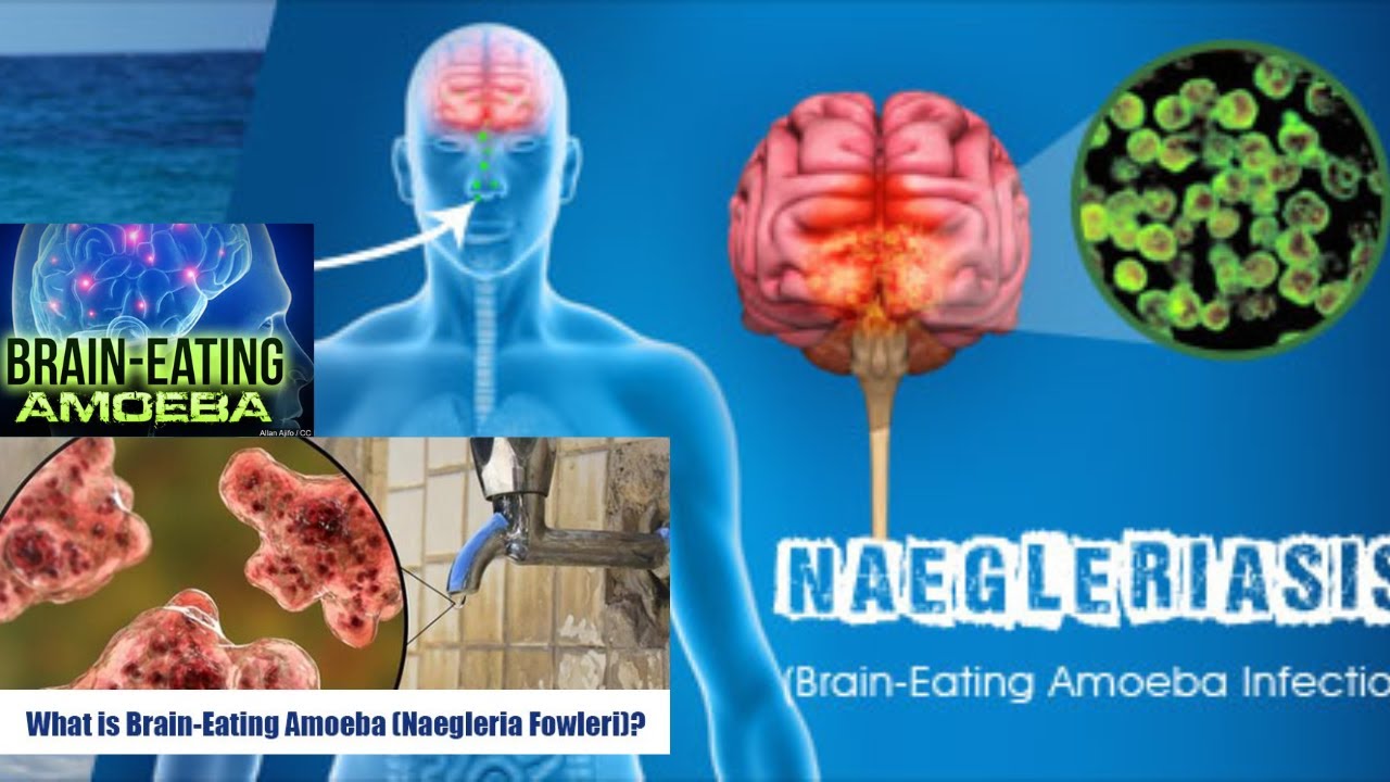 brain-eating amoeba | Naegleria fowleri explain | prevention and ...