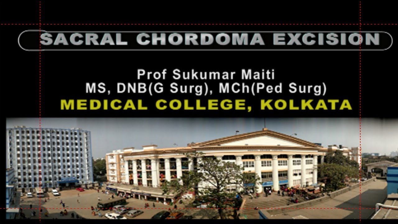SACRAL CHORDOMA EXCISION - YouTube