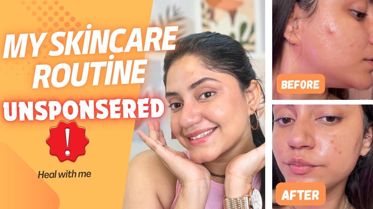 My Skincare Routine For Glass Skin 🧴 Clear Skin Challenge Acne