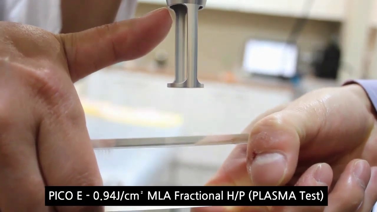 Laser‐ induced optical breakdown (LIOB) là gì? | MÁY THẨM MỸ H&A GROUP ...