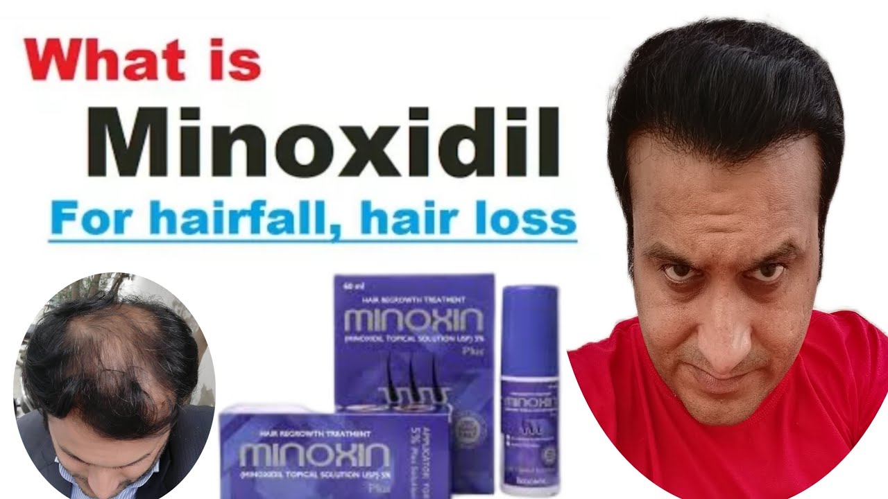 How to use minoxidil spray Method |Right way to use MINOXIDIL SOLUTION ...