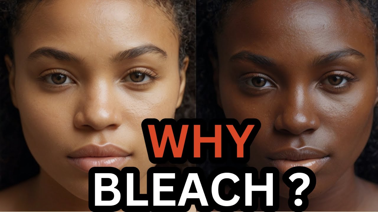 Why Do People Bleach Their Skin? Episode 19 - YouTube