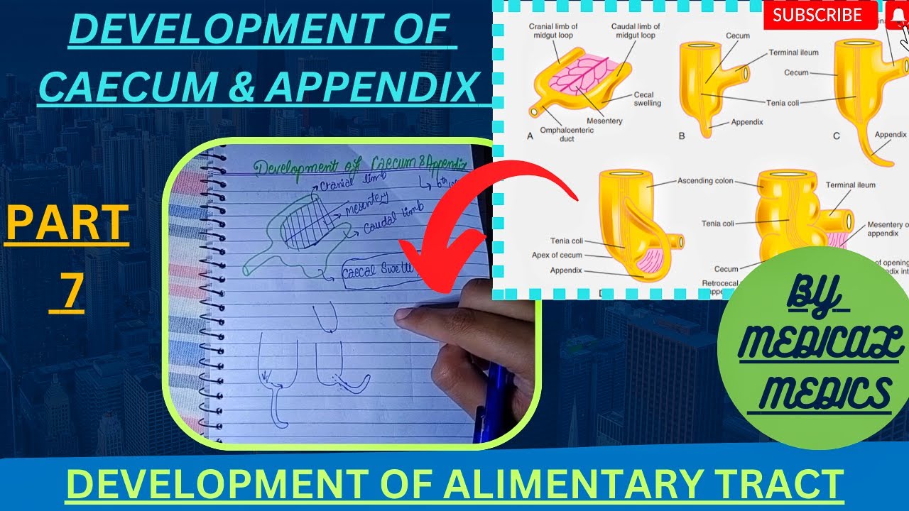 Development of Caecum and Appendix | Development of Alimentary Tract ...