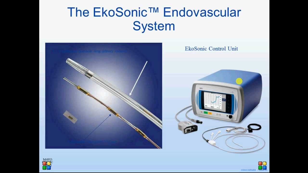 Session 5. Treatment of Acute DVT 5.4 - YouTube