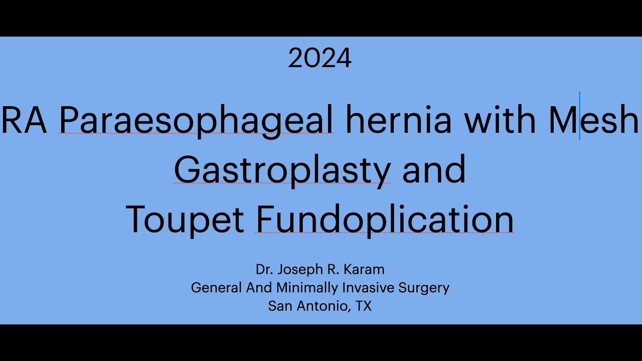 Robotic Paraesophageal hernia repair with mesh, gastroplasty and toupee ...
