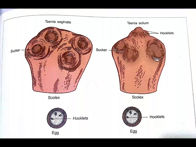Taenia Solium E Taenia Saginata Taeniasis Altmeyers Encyclopedia