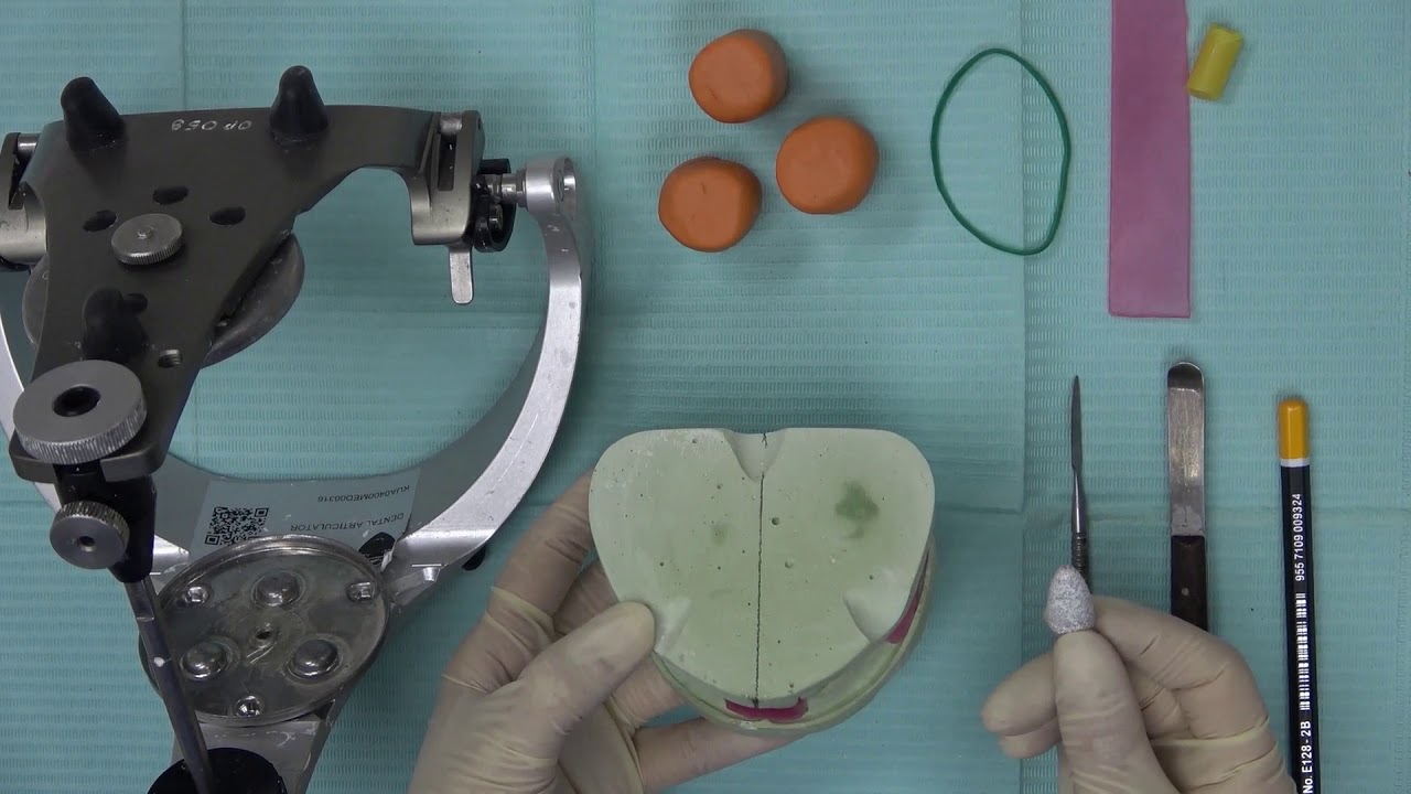 MOUNTING FOR PARTIAL ACRYLIC DENTURE - YouTube