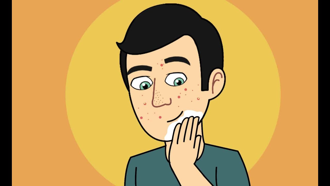 Manage Rosacea + Seb Derm Combo - YouTube