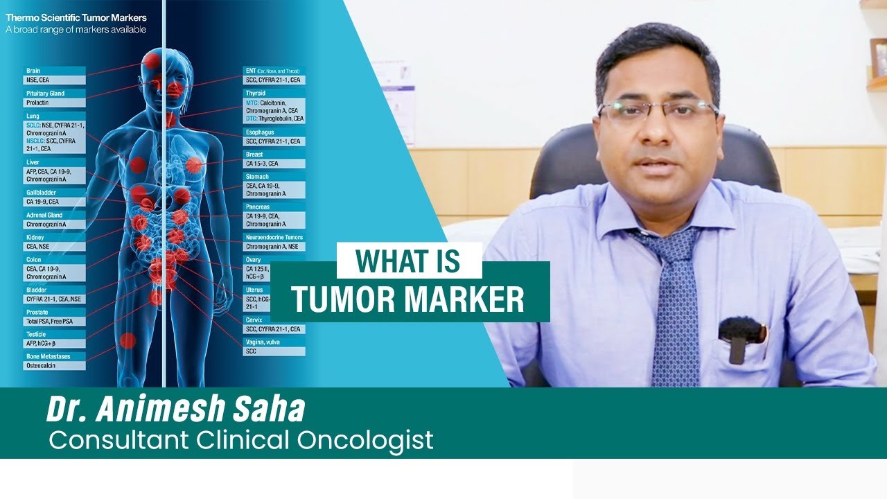 Tumor Marker | Cancer Marker | Biomarker | Cancer diagnosis | Cancer ...