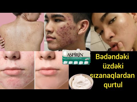 Sizanaqlara qarsi maska