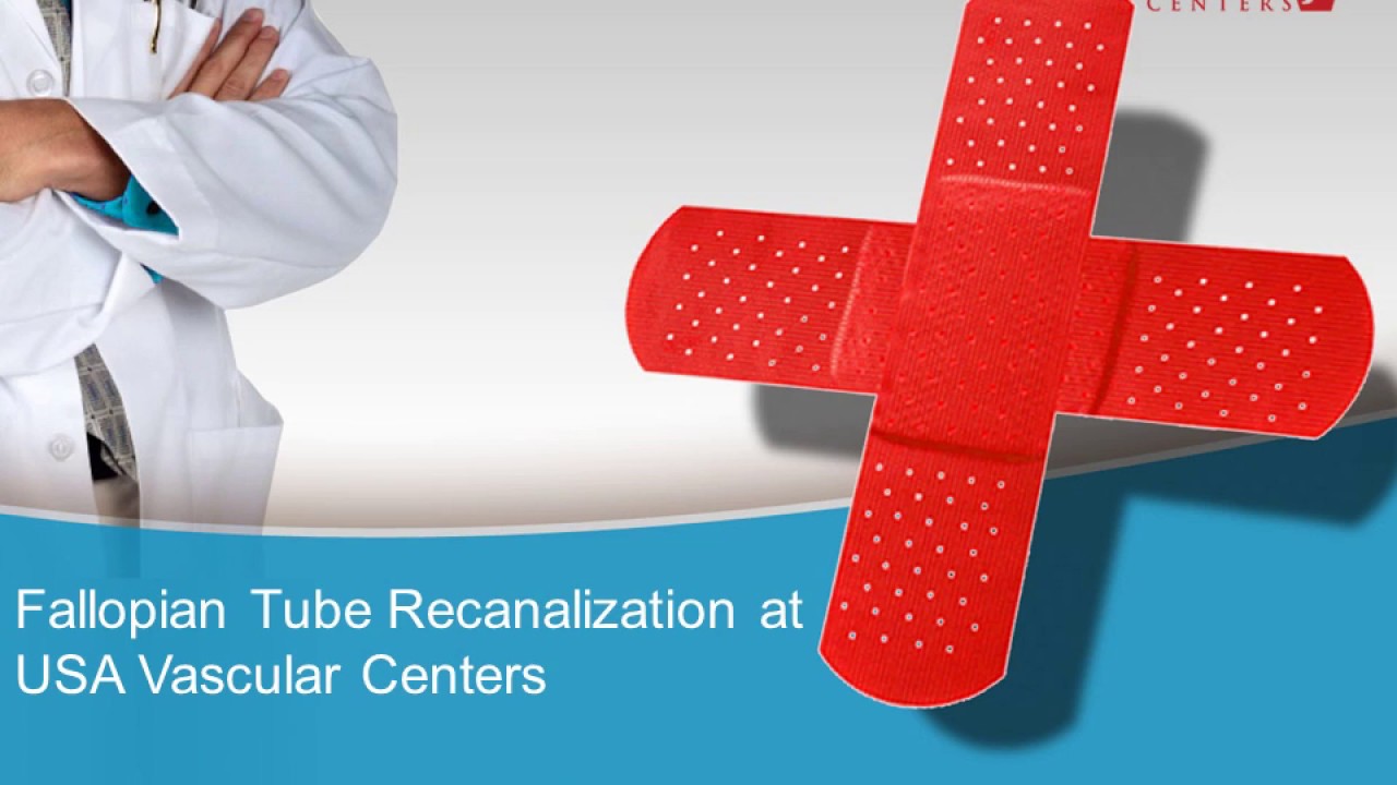 Infertility Fallopian Tube Recanalization