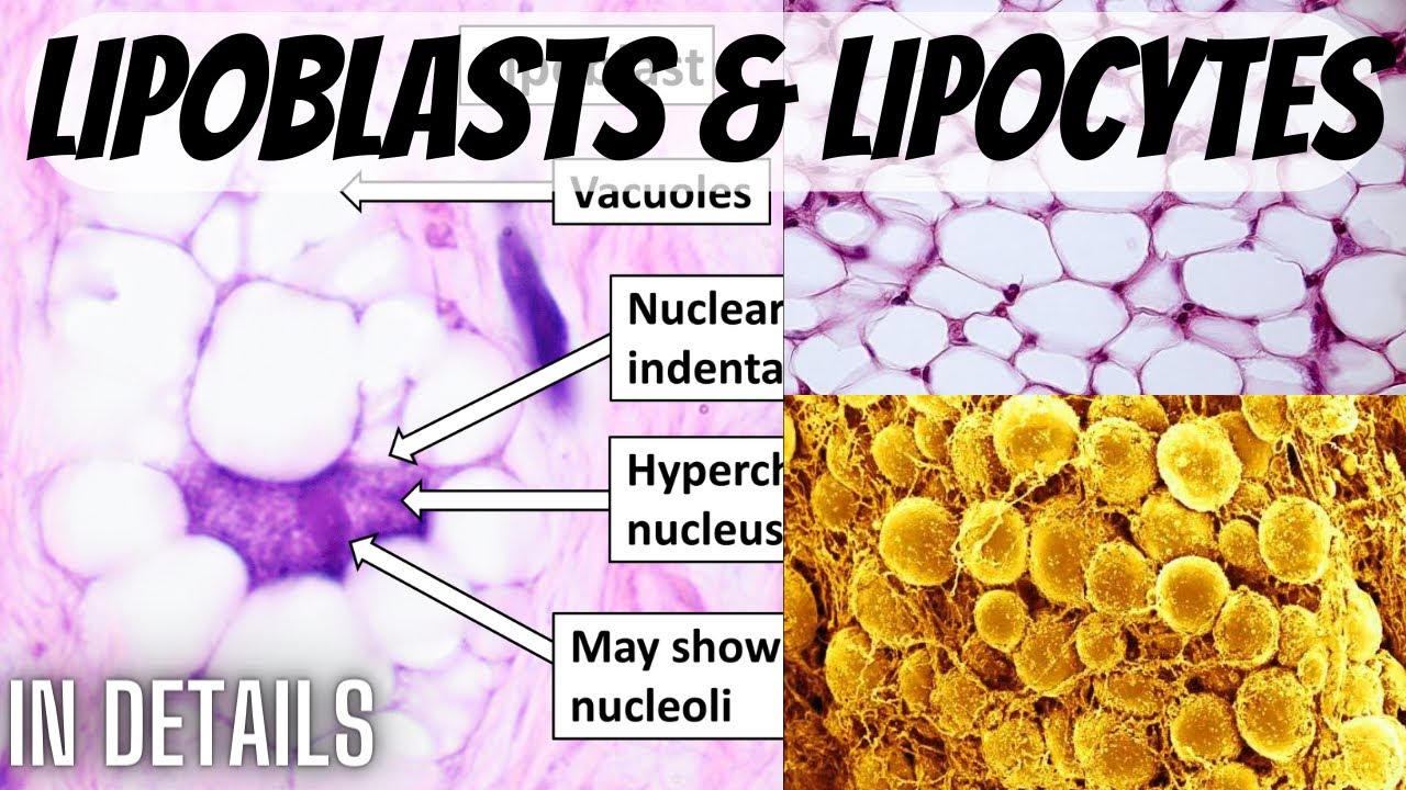 Lipoblasts & Lipocytes in details. Cytology part 66. - YouTube