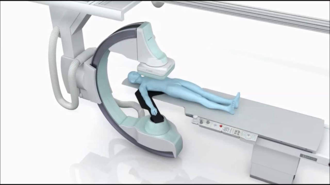 Transverse movement of C-arm - YouTube