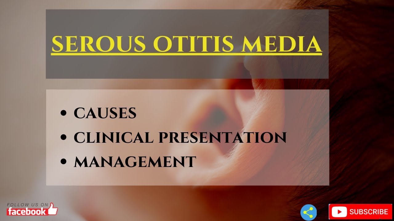 docplus - serous otitis media | SOM | ENT | full explanation of serous ...