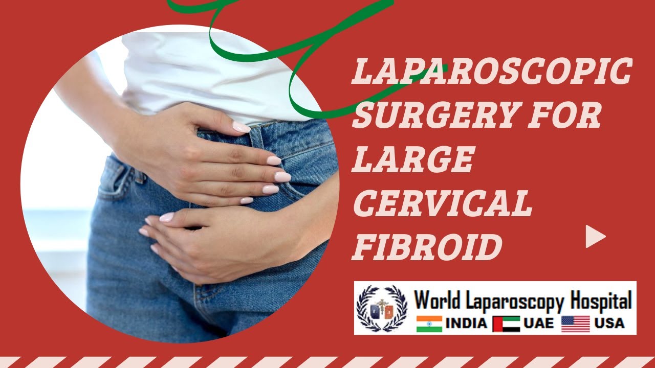 Laparoscopic Removal of Large Posterior Cervical Fibroid - YouTube
