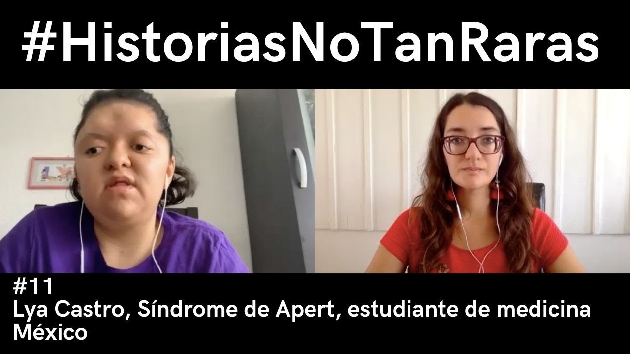 #HistoriasNoTanRaras 11 Lya Castro, Síndrome de Apert, estudiante de ...