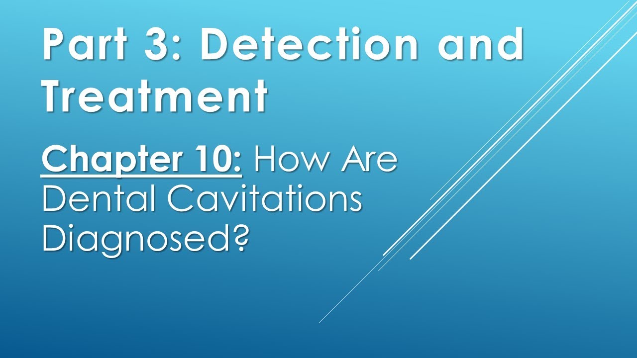 Part 3. Chapter 10: How Are Dental Cavitations Diagnosed? - YouTube