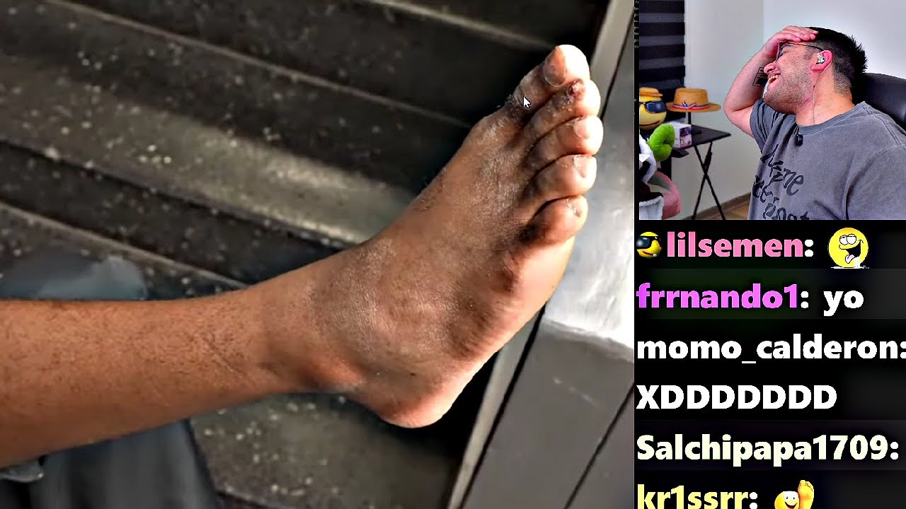 La pata de speed 🤢 - YouTube