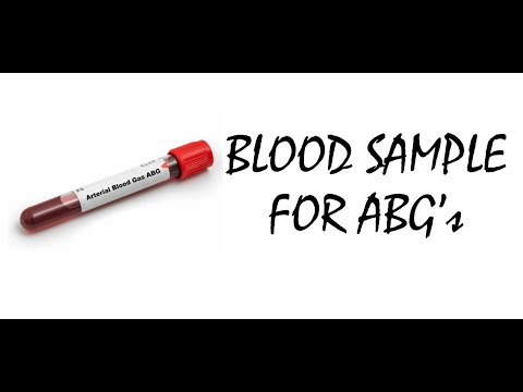 How to Take Blood Sample for Arterial Blood Gases ( ABG's ) - YouTube