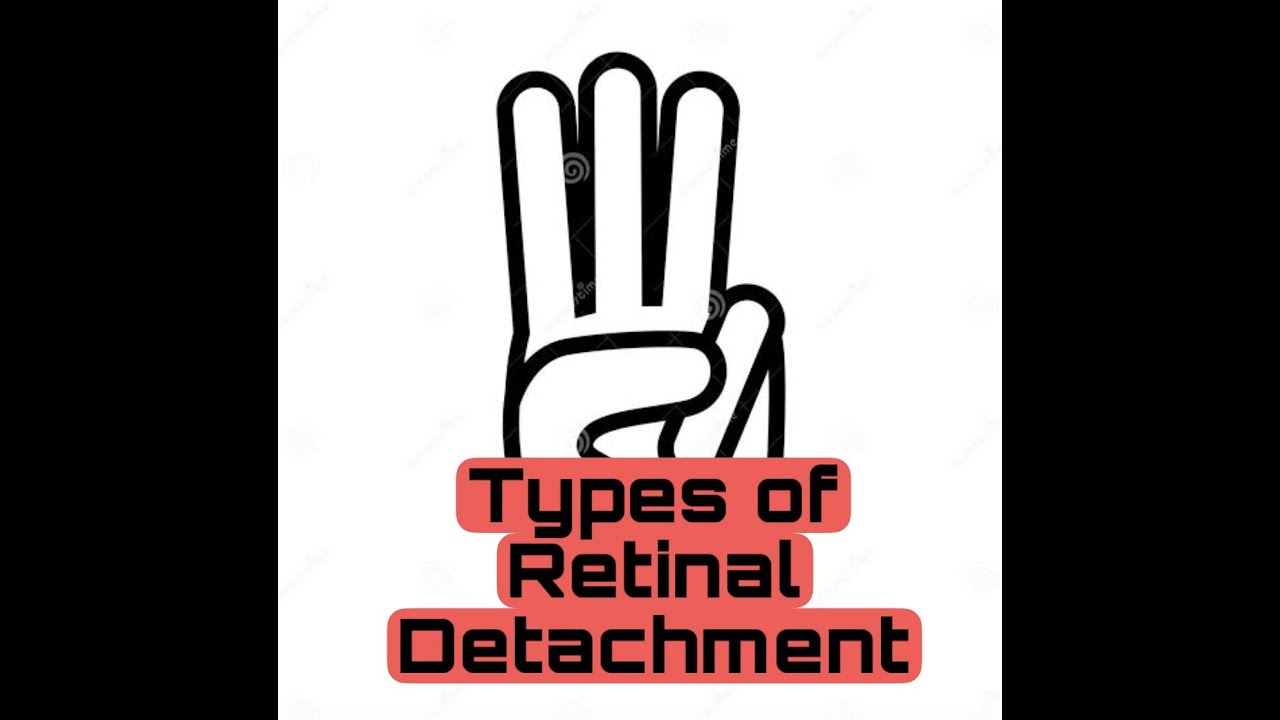 The 3 Types of Retinal Detachment/ #retinaldetachment - YouTube