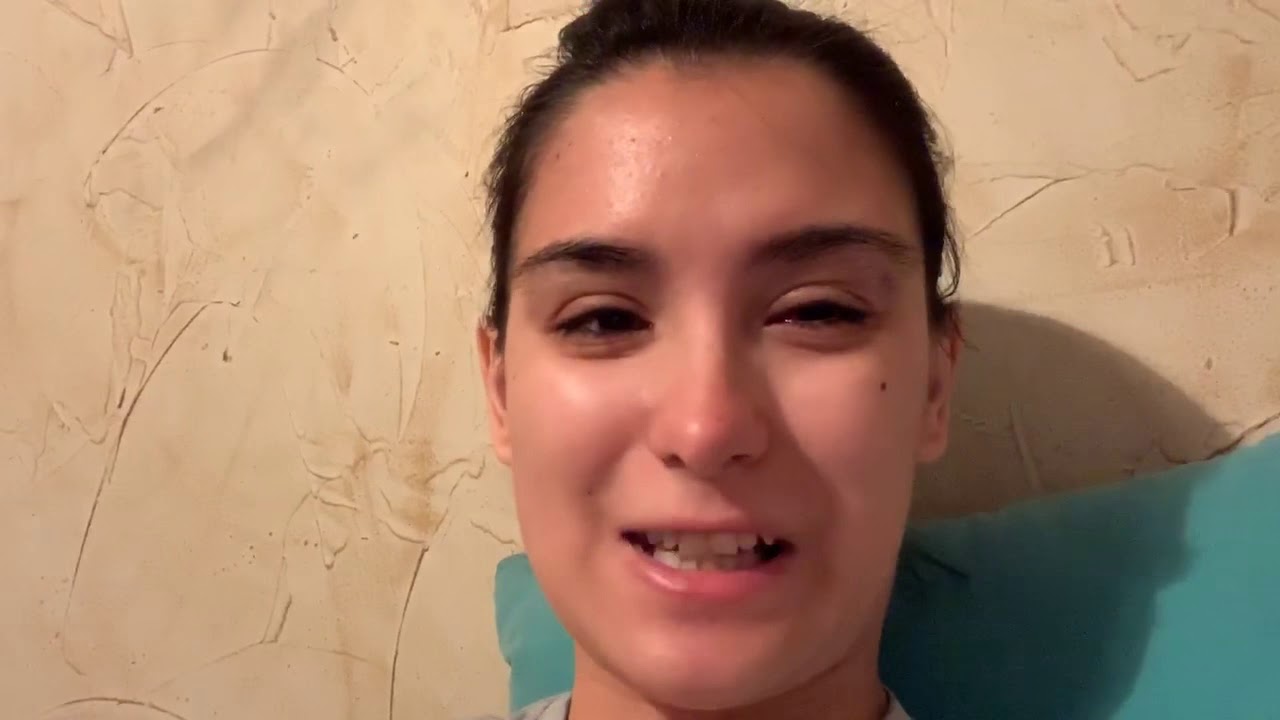 Strabismus Surgery & Day 1 Recovery (8-27-28-19) - YouTube