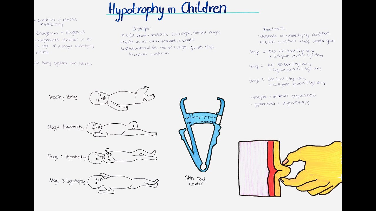 Hypotrophy in Children - Endogenous + Exogenous - YouTube
