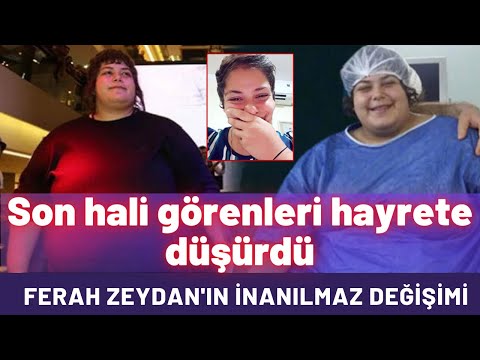 Şarkıcı Ferah Zeydan'ın İnanılmaz Değişimi