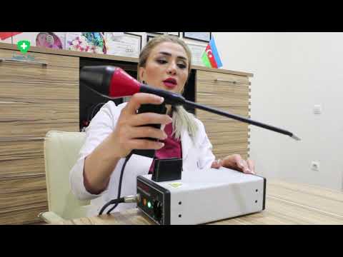 Qanayan Daxili babasillərin infra qırmızı lazerlə əməliyyatı