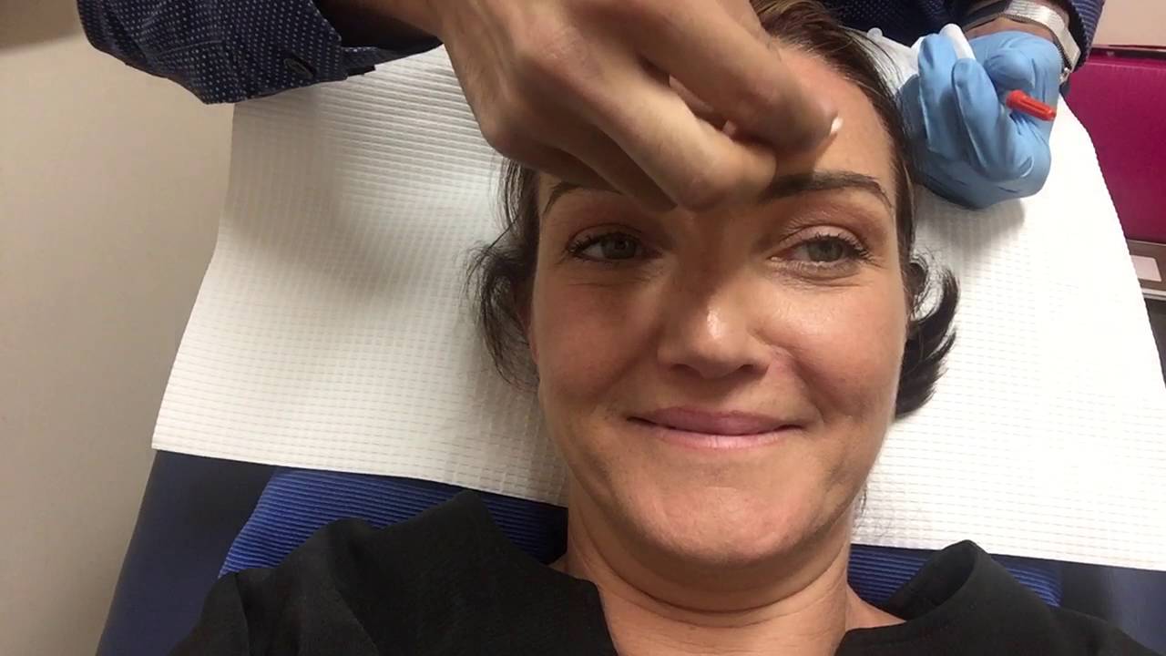 Anti Wrinkle Injection | Dr. Ahmed Omarjee - YouTube