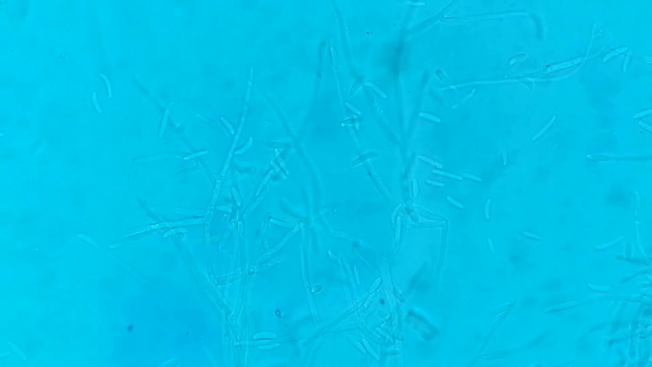 Fusarium growth on SDA and its structures in LPCB preparation - YouTube
