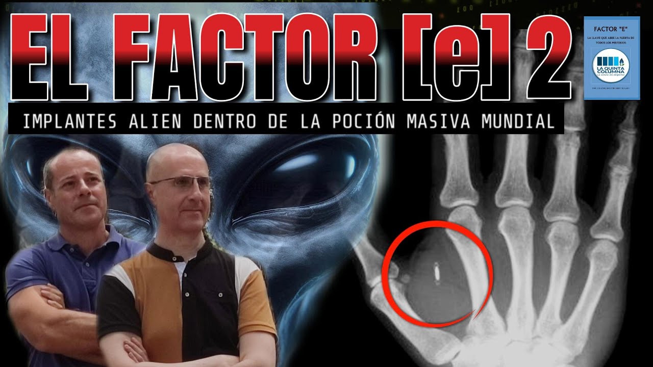 IMPLANTES ALIEN DENTRO DE LA POCIÓN MASIVA MUNDIAL 2/3.- - YouTube