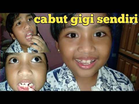 Drama cabut gigi sendiri || alisha berani atau engga ya... - YouTube