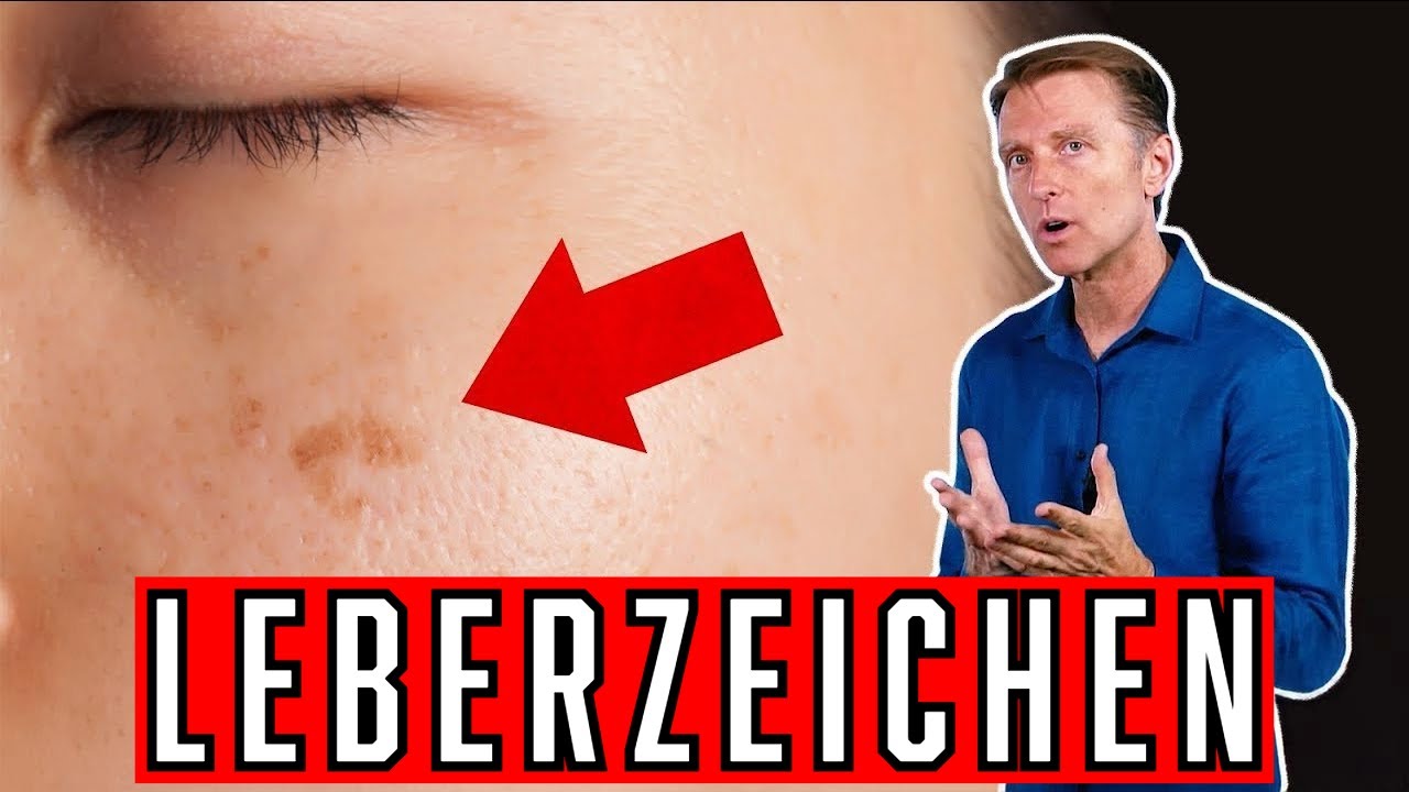 WARNUNG: 9 HAUTZEICHEN EINER KRANKEN LEBER! 🔍 - YouTube