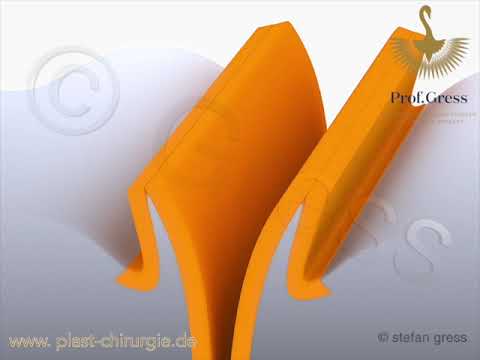 Labia Reconstruction – Repair of the Labia Minora Using Vaginal Skin | Prof. Dr. Gress