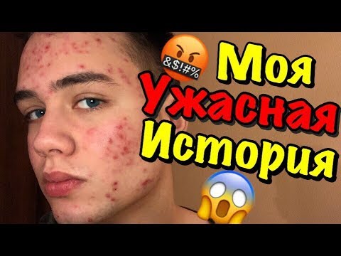 МОЯ УЖАСНАЯ ИСТОРИЯ | МЕНЯ ПЫТАЛИСЬ ИЗУРОДОВАТЬ