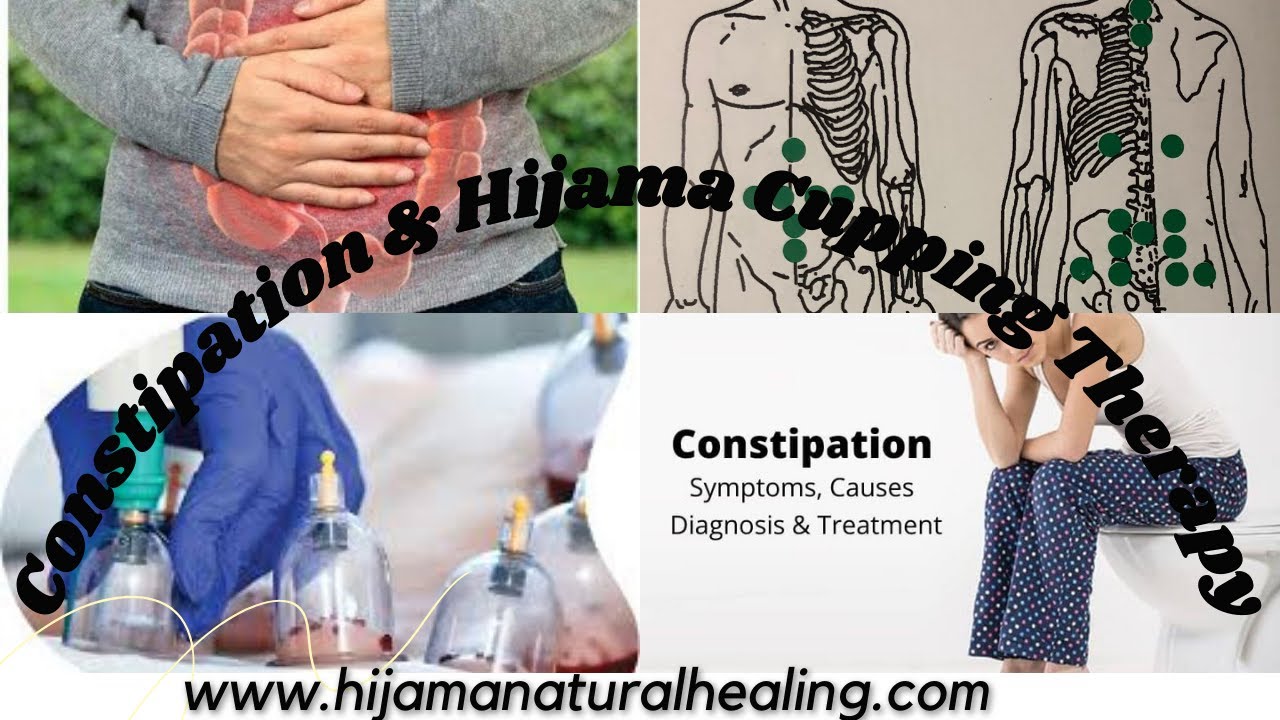 Constipation & Hijama cupping therapy | Cupping Therapy | Hijama ...