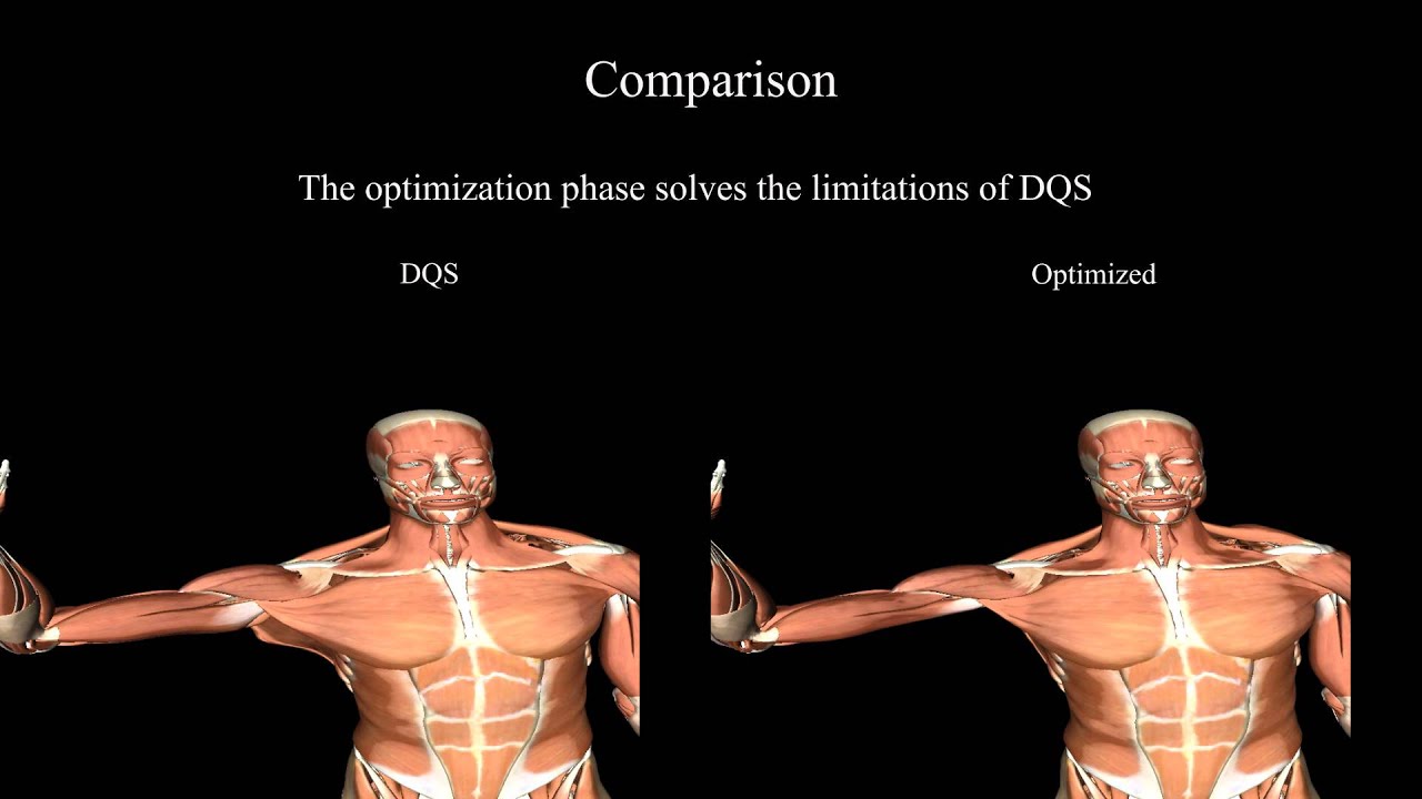 An Interactive Algorithm for Virtual Patient Positioning - YouTube