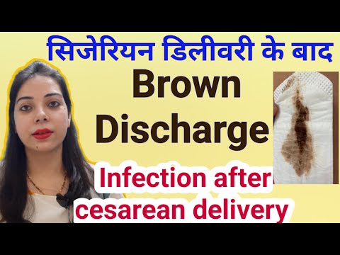 Cesarean डिलीवरी के बाद Brown Discharge क्यों होता है | Infection after Delivery | IndianMomsNest