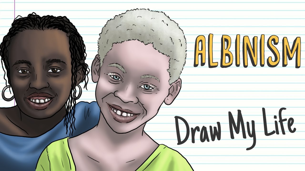 ALBINISM | Draw My Life - YouTube