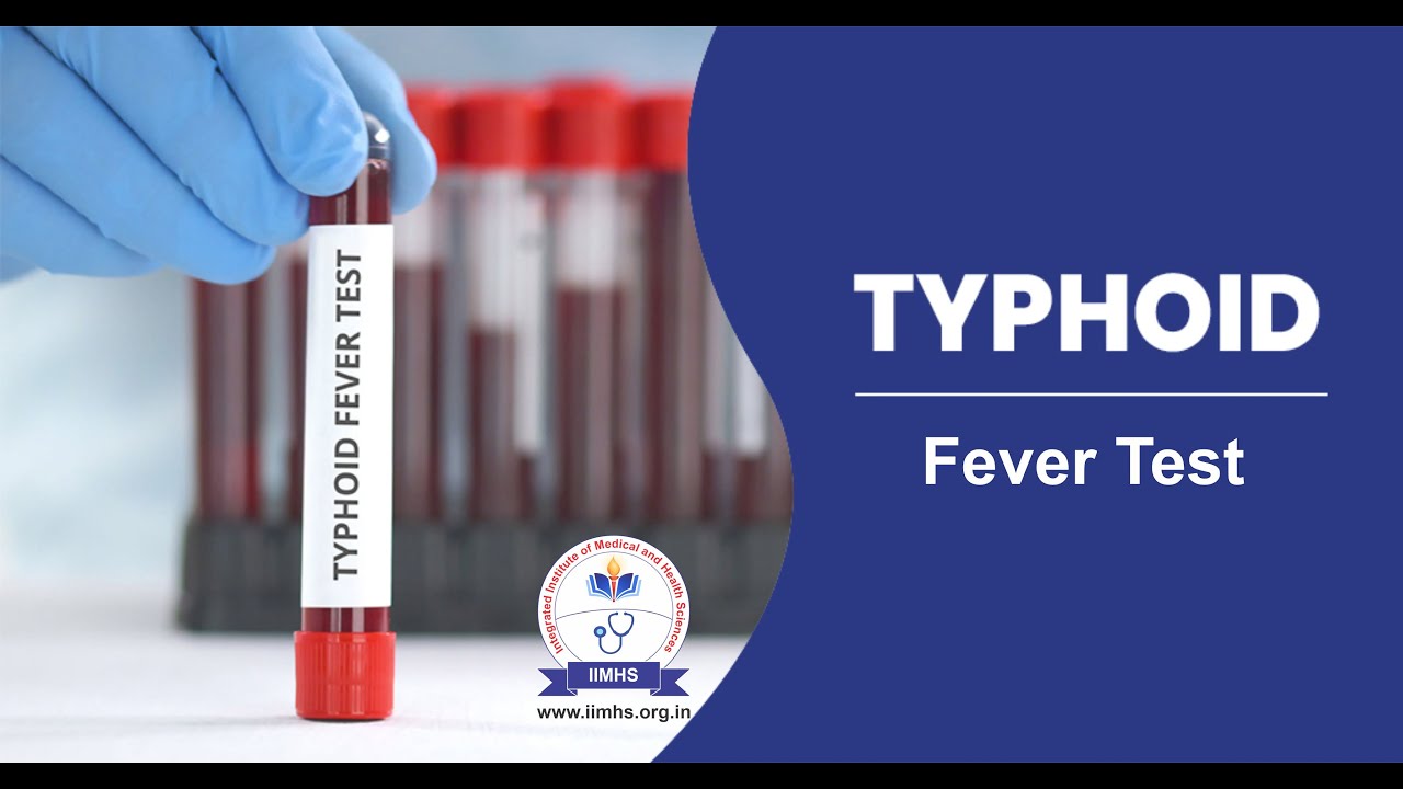 Typhoid Blood Sample - YouTube