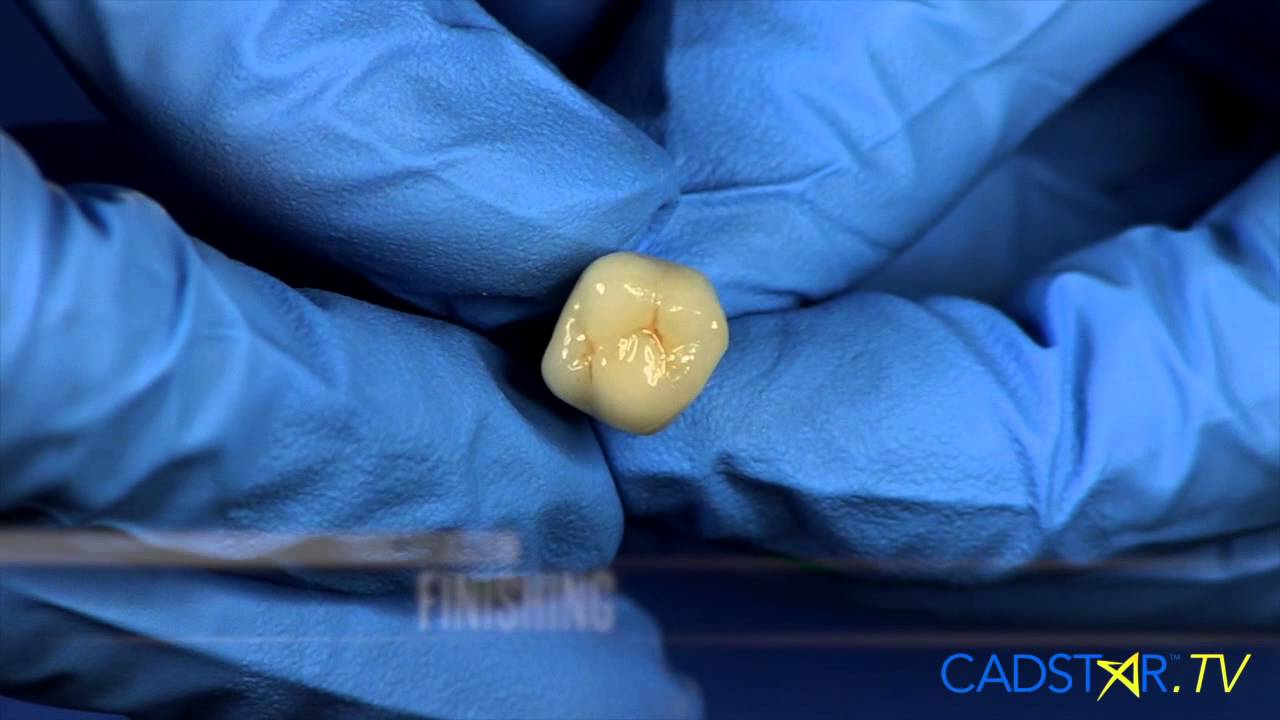 Chairside CEREC Implants and Abutments, with James Klim, DDS - YouTube