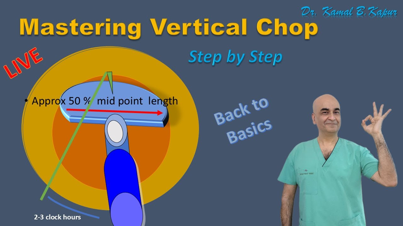 Mastering a VERTICAL Chop - Step by step ( Back to Basics) -Dr Kamal B ...