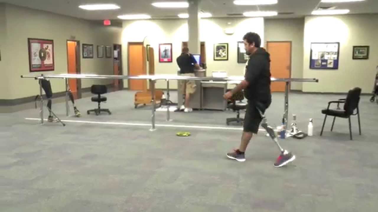 Alex - Hip Disarticulate Amputee - YouTube