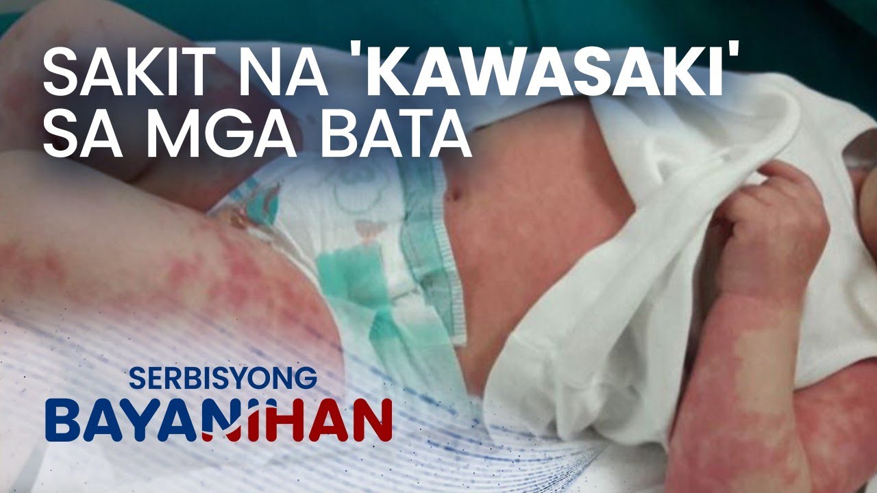 Ano ang ‘Kawasaki Disease’ at paano ito nakaka-apekto sa ating mga anak ...