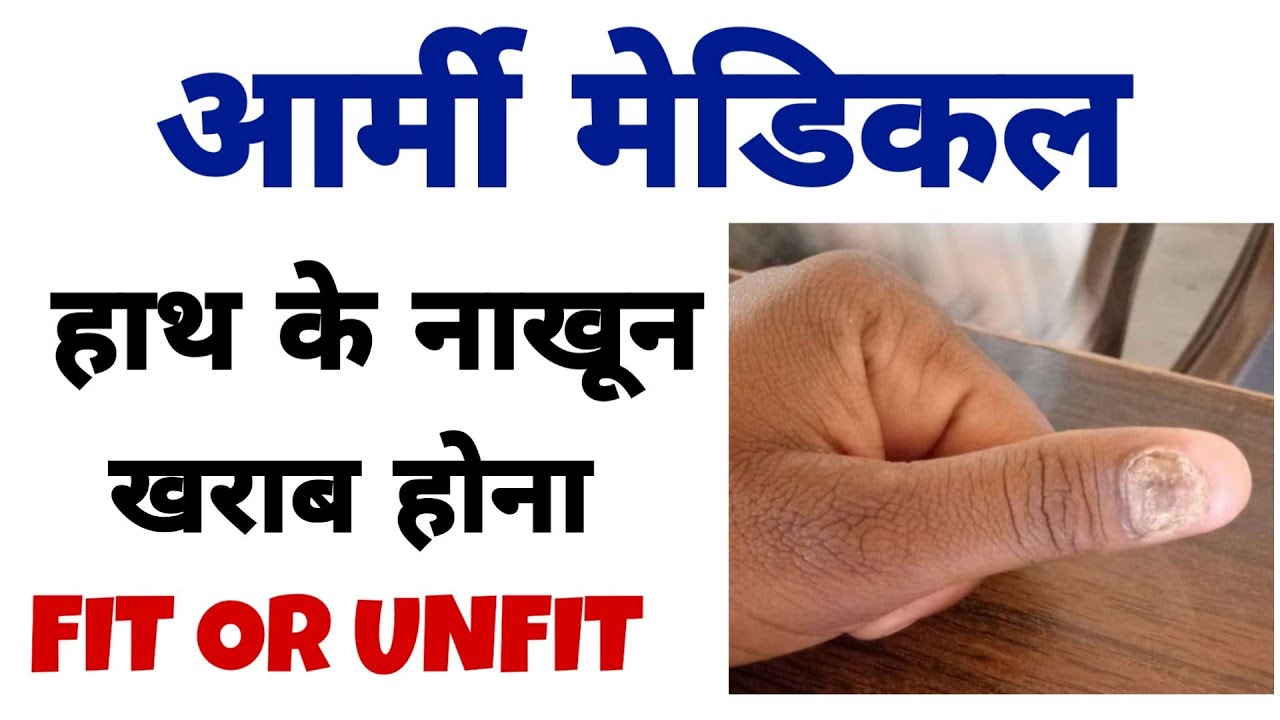 Indian Army Medical Test For GD, Clerk, Technical Bharti - YouTube