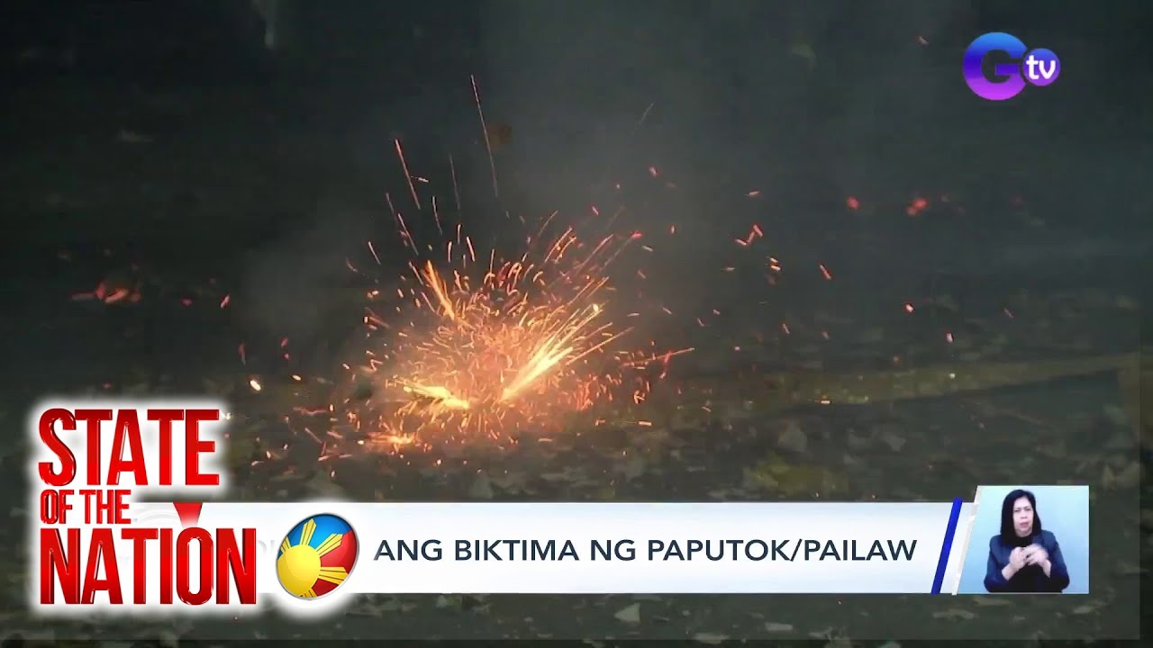 DOH: 441 ang biktima ng paputok/pailaw | SONA - YouTube
