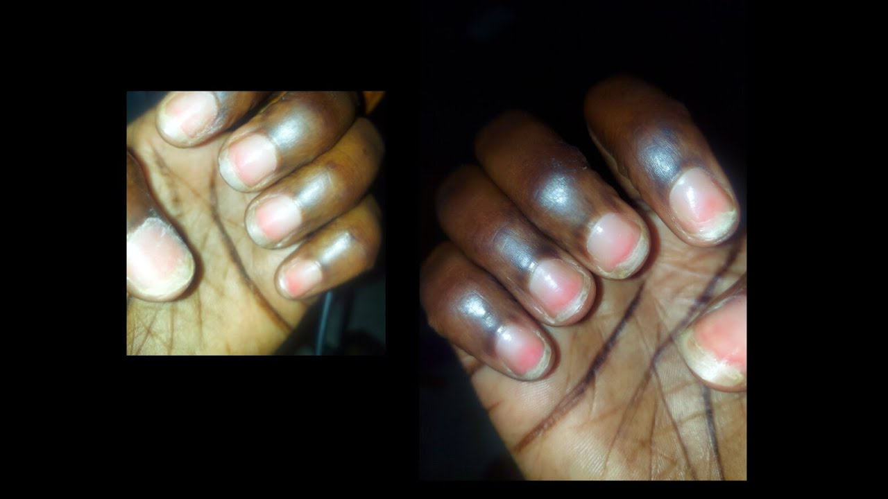 Removing old clear polish & then file & paint them again my nail care ...