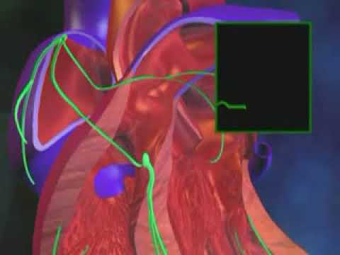 TEST D'EFFORT - ECG - YouTube